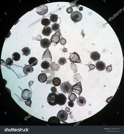 Protozoa Under Microscope Labeled