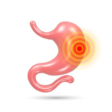 Premium Vector Stomach Pain And Heartburn Digestive Disease Gastritis