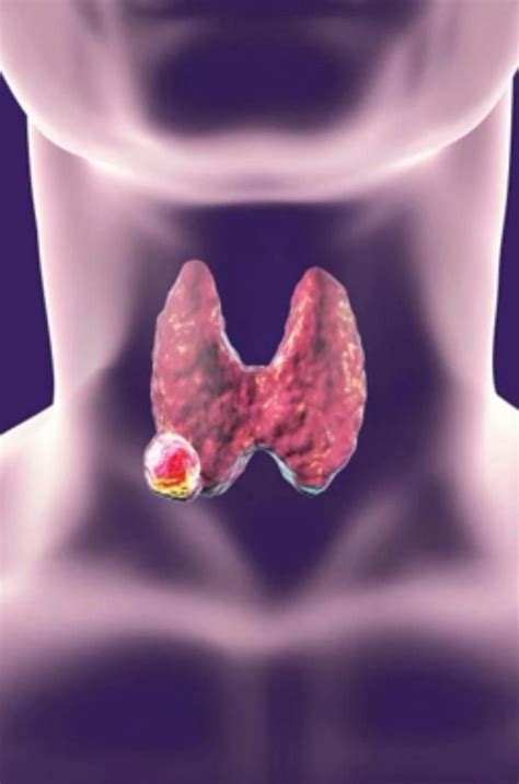 🔥 How To Improve Thyroid Function Naturally Best Foods And Remedies In