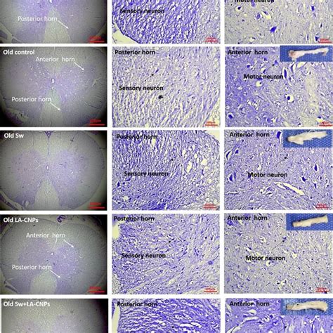 Graphical Depiction Of A Histological Staining Of Spinal Cord Tissue