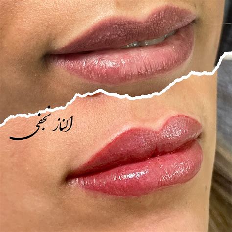 ‎الناز نجفی میکروشیدینگ لببنمژه‎ Elnaznajafipmu • Instagram Photos And Videos
