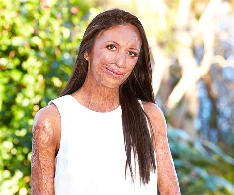 Turia Pitt Reveals Her Health And Fitness Secrets