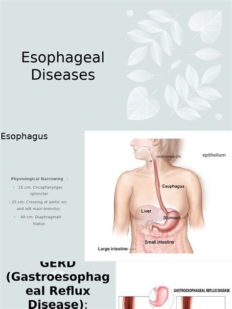 Esophageal Diseases 1 Pdf