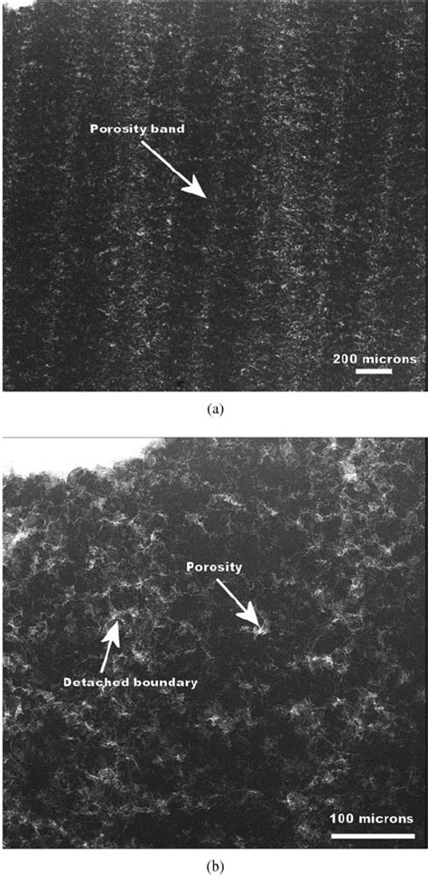 X Ray Microscopy ~ A Low Magnification And ~ B High Magnification