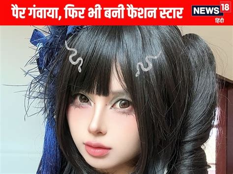 12 साल की उम्र में हुआ था कैंसर इसलिए काटना पड़ा बायां पैर लेकिन नहीं