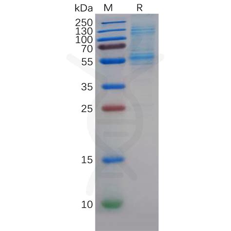 Buy Human Dll3 Protein His Tag Dll3 Recombinant Protein Dima Biotech