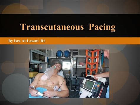 Transcutaneous Pacing Ppt