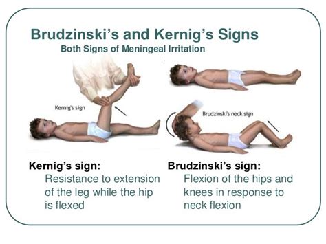 Neurological Examination In The Emergency Room