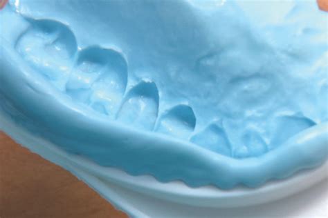 Integrity Multi Cure Temporary Crown And Bridge Material Mayjune