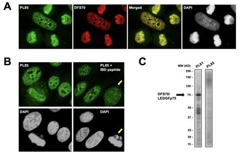 Analysis Of Clia Anti Dfs70 Negative Serum Pl85 A The Monospecific