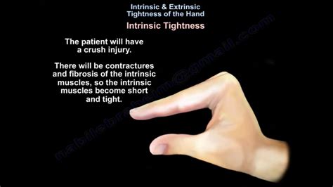 Difference Between Intrinsic And Extrinsic Muscles Of The Hand