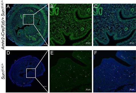 Icre Recombinase Expressed In The Anti Müllerian Hormone Receptor 2 Gene Causes Global Genetic