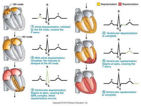 Atrial Repolarization Wave