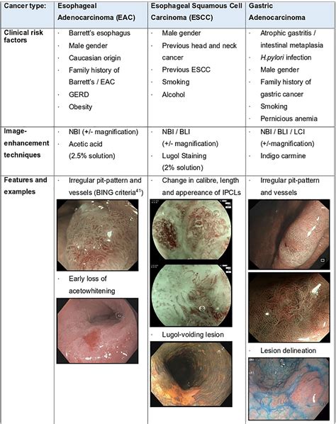 Upper Gi Endoscopy