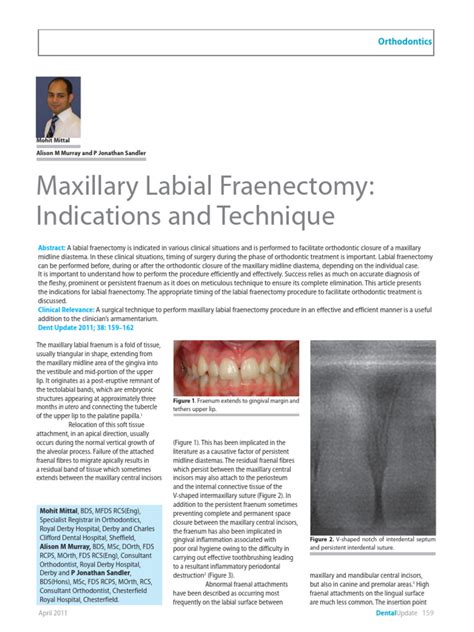 Maxillary Labial Fraenectomy Guide Pdf Orthodontics Dentistry