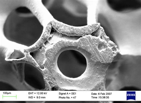 Innovations Ideals Osteogene