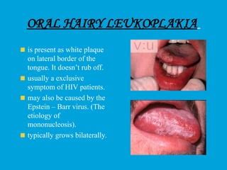 The Tongueppt For Prosthodontics In D Ppt
