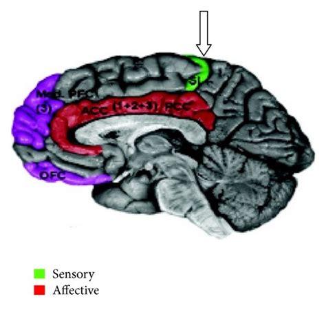 Sensory Cortex Lobe Location