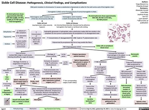 Sickle Cell Disease Pathogenesis Clinical Findings And Complications Calgary Guide