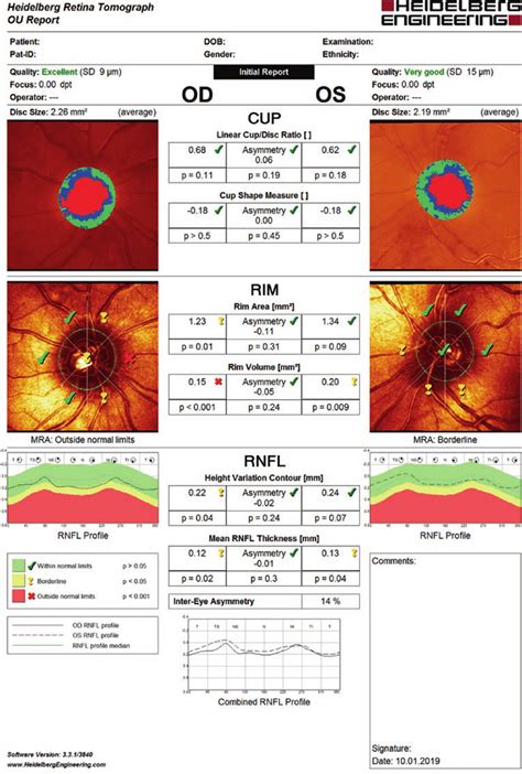 1 After Manually Delineating The Optic Disc Margin By Placing A Contour