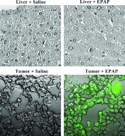Uptake Of Epap By Normal Liver Tissues And The Hepg2 Tumors Treated By Download Scientific
