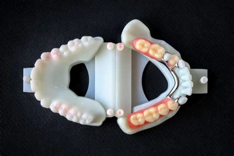 Surface Cleaning Partial Chrome Flexible Denture For Clinical At Best Price In Hyderabad