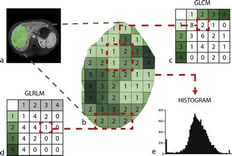 Schematic Overview Of The Texture Analysis Process First A Roi Has To