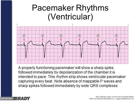 Appendix E Pacemakers Gail Walraven Basic Arrhythmias Seventh Edition
