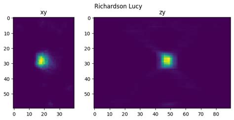 Deconvolution Vs Ai Deblurring For Microscopy Image Analysis