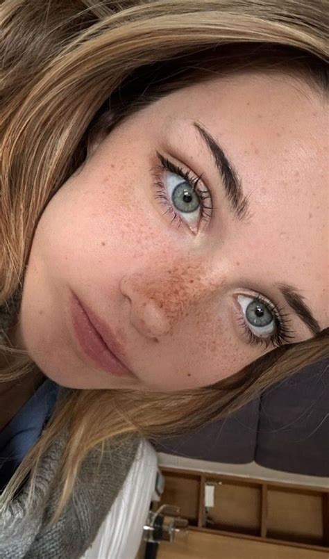 Freckles Girl