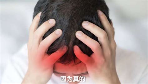 颈（源）椎性头痛有什么表现？ 京东健康