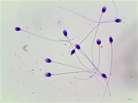 Buy Canmorph Prestained Sperm Morphology Slides Kit At Candore