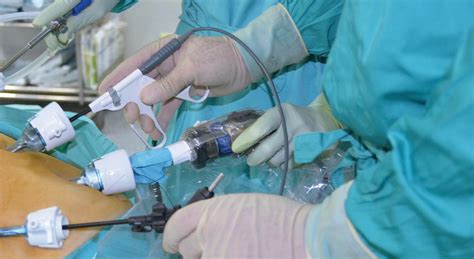 Postgraduate Certificate In Exploratory Laparoscopy And Benign Adnexal Pathology In Gynecology