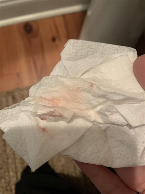 Implantation Bleeding Or Miscarriage R Tryingtoconceive