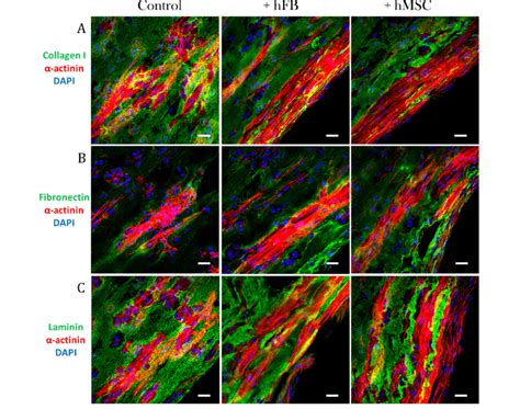 Niche Cell Supplementation Promotes Alignment Of Ecm Bundles With Download Scientific Diagram