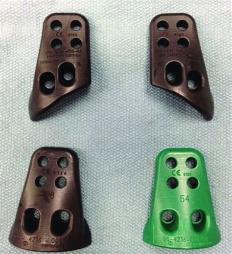 Acetabular Distraction Bone And Joint