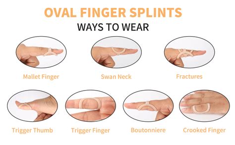 Cagsig Oval Finger Splints 5pcs Oval Trigger Finger Splint