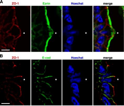 Redistribution Of The Tight Junction Protein Zo 1 During Physiological Shedding Of Mouse