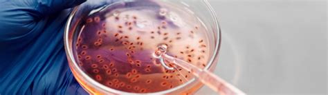 Top 6 Bacteria Identification Methods Mega Pharmacy 4u Be Better