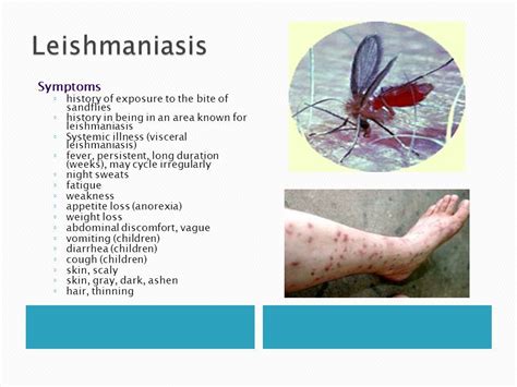 Leishmaniasis Causes Symptoms Diagnosis And Treatment