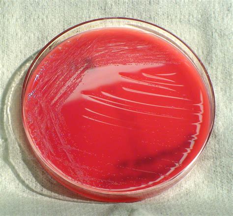 Public Domain Picture This Photograph Depicts Light Colonial Growth