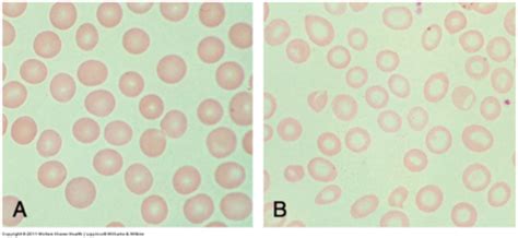 Exam 2 Review Disorders Flashcards Quizlet