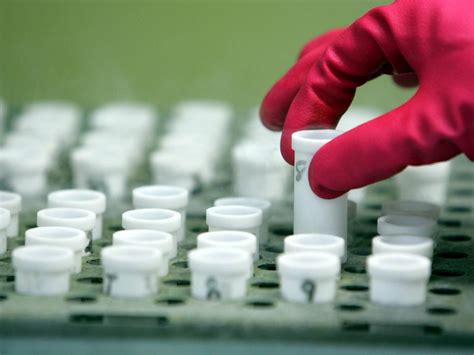 Major Breakthrough From Australian Researchers In Hiv Study The
