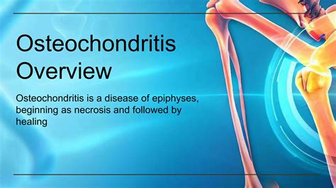 Osteochondritis And Related Diseases Pptx
