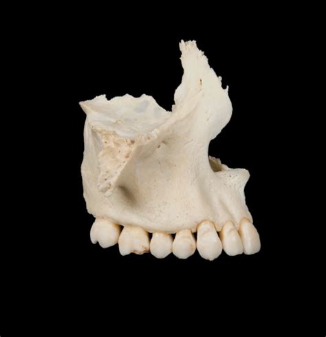 27 Maxilla Lateral View Right Side Diagram Quizlet