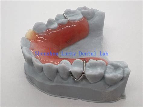 China Partial Acrylic Denture Manufacturers Suppliers Factory Customized Service