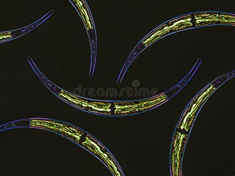 Closterium Sp Charophyta Algae Under Microscopic View X40 Green Algae
