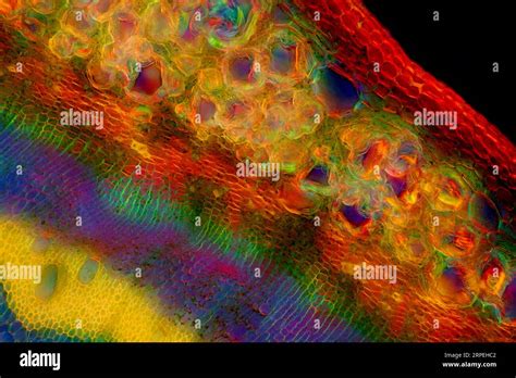 The Image Presents Nettle Tissues In The Stalk In Transversall Cross