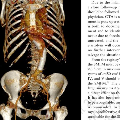 The Streamliner Multilayer Flow Modulator Cardiatis Download Scientific Diagram