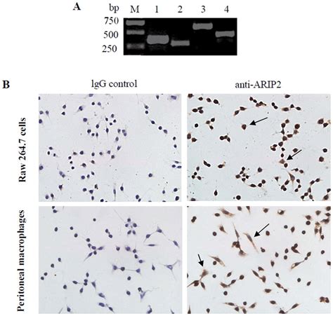 Expression Of Arip2 In Mouse Macrophages A Expressions Of Arip2